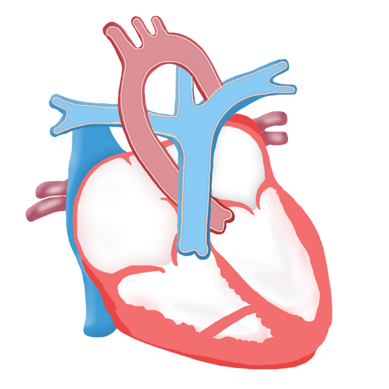 Ventriculoarterial Connections - SonoShare