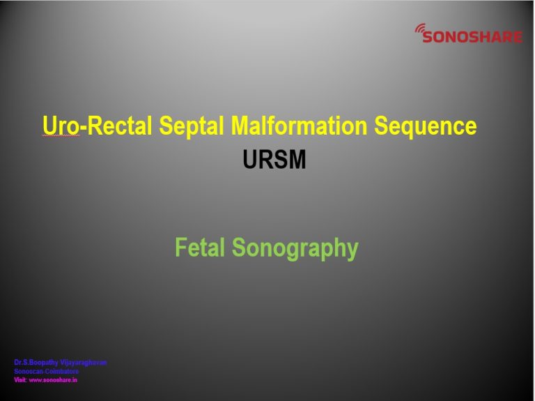 Fetal Urorectal Septal Malformation Sequence (URSM) - SonoShare