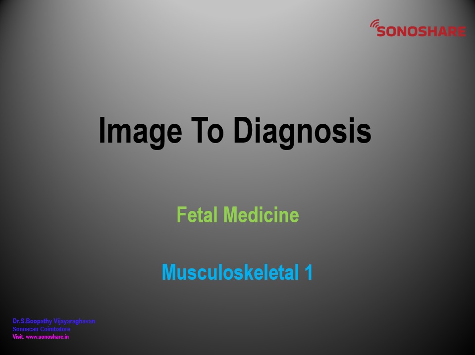 Image to Diagnosis – Fetal Medicine 34 -Musculoskeletal 1 - SonoShare