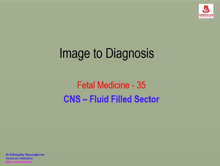 Image to Diagnosis – Fetal Medicine 36 – CNS - SonoShare